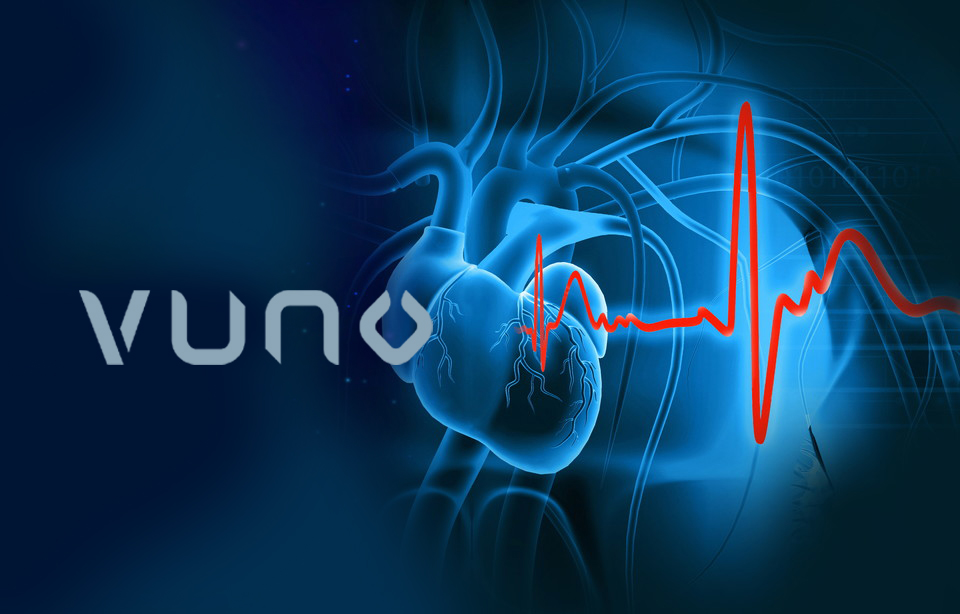 뷰노, 국내 최초 의료 인공지능 '뷰노메드 딥카스' 선진입 의료기술 확정...비급여 사용 가능