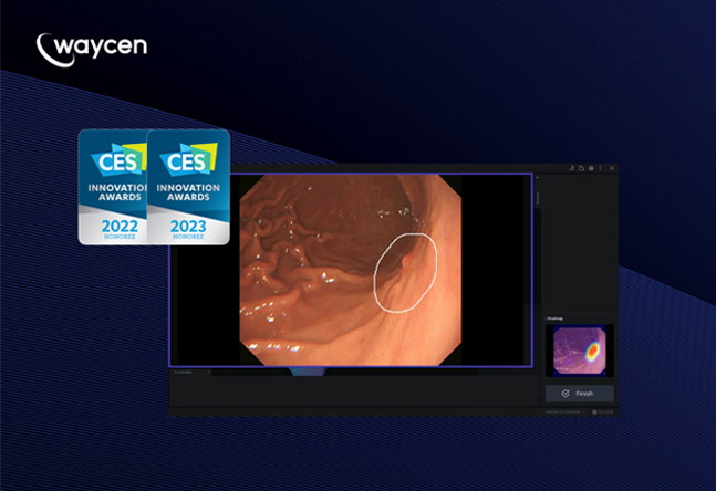 웨이센, AI 소화기 내시경으로 중동시장 공략한다