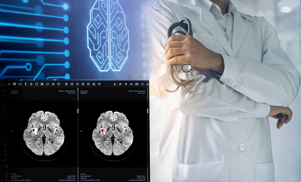 제이엘케이 AI 뇌졸중 솔루션 ‘JBS-01K’, 한국보건의료연구원 공식 승인