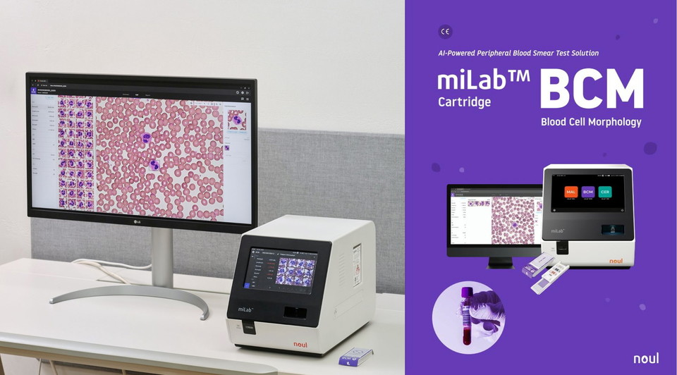 노을, AI 혈액 분석 솔루션 이탈리아 대형병원 및 검진센터 공급∙∙∙첫 유럽 시장 매출
